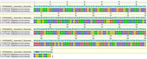 multiple sequence alignment of s aureus partial nucleotide sequence of