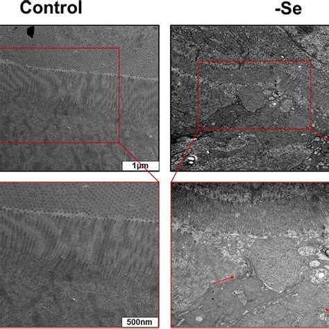 Principal Component Analysis Of Intestinal Selenium Protein And Download Scientific Diagram