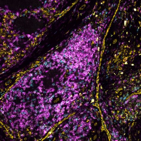 Lunaphore To Present New Data At The Society For Immunotherapy Of Cancer Sitc 37th Annual