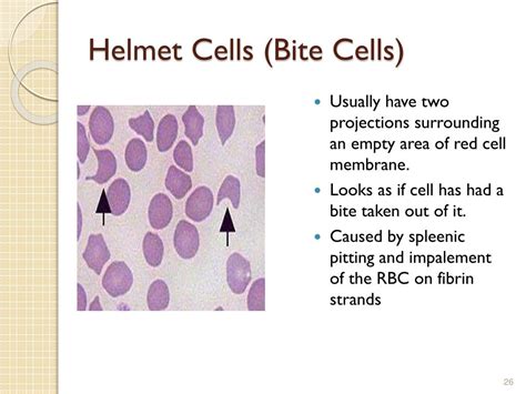 Ppt Mlab 1415 Hematology Keri Brophy M Artinez Powerpoint