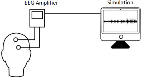 Figure 1 From Automatic Detection Of Epileptic Seizures From Eeg Signals Using Artificial