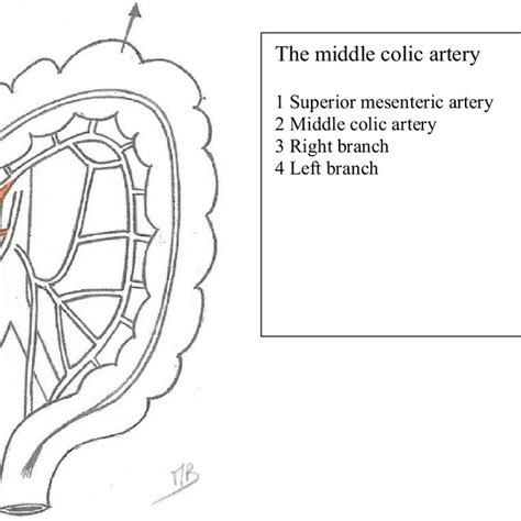 Three Arterial Arches At The Left Colic Angle Download Scientific Diagram