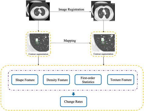 An Effective Malignancy Prediction Model For Incidentally Detected Pulmonary Subsolid Nodules