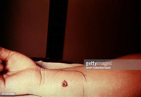 Anthrax Photos And Premium High Res Pictures Getty Images