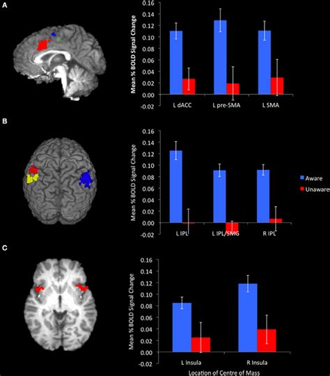 Frontiers Error Related Anterior Cingulate Cortex Activity And The Prediction Of Conscious