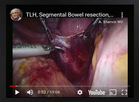 General Surgery Isge