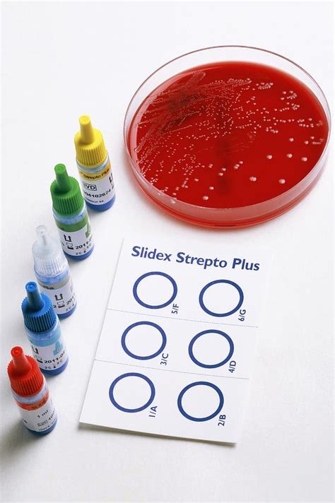Streptococcus Grouping Test 2 By Science Photo Library