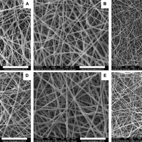 Sem Micrographs Of Coaxial And Single Needle Pcl Based Membranes With Download Scientific