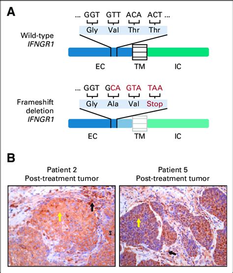 Tumor Resistance Associated With A Truncating Frameshift Deletion In Download Scientific