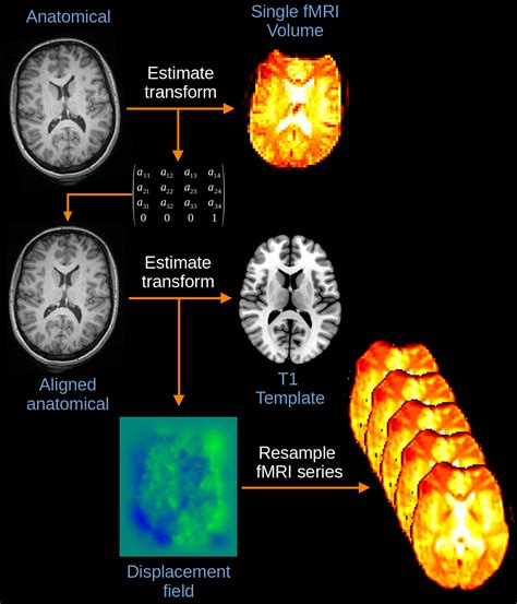 Step 3 Normalisation — Fmri Image Preprocessing Step 3 Normalisation — Fmri Image Preprocessing