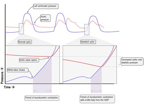 Benefits Of An Iabp Assisted Decrease In Aortic Pressure Deranged