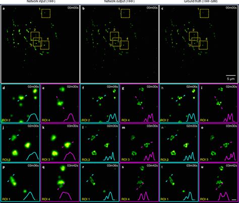 Deep Learning Enabled Cross Modality Image Transformation From Tirf To Download Scientific