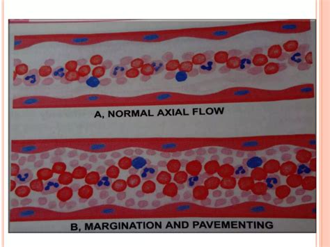 Patho Inflammation Pptx