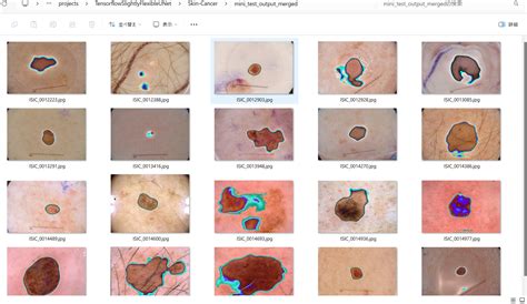 Github Sarah Antilliatensorflow Image Segmentation Augmented Skin Cancer Tensorflow Image