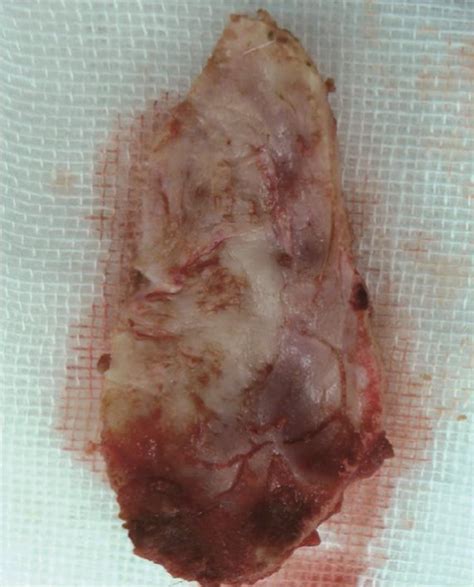 X Ct Micro Ct Imaging And Statistical Analysis A Sagittal Ct