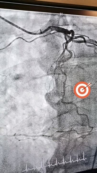 Nenad Ž Božinović Md Ass Profesor Of Internal Medicine On Linkedin