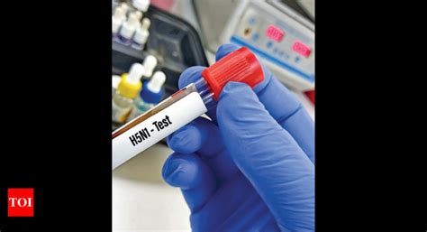 Testing Not Must For All Influenza Patients And Contacts Maharashtra