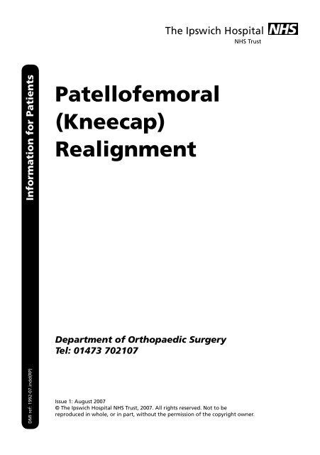 Patellofemoral Kneecap Realignment Ipswich Hospital