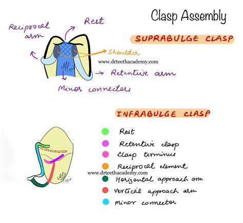 Drteeth A Clasp Assembly Has The Following Parts 1 A Facebook