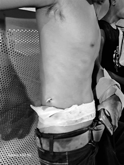 မော်လမြိုင်မြို့ တောင်ကွင်းကျောင်းပွဲခင်းအတွင်း အမျိုးသား ၅ ဦး ဓားထိုးခံရ၍ ဒဏ်ရာရ People