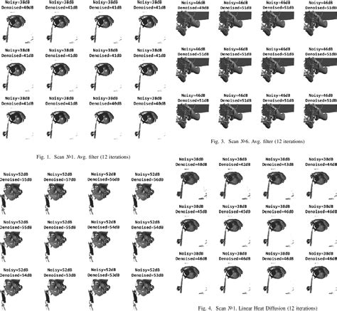 Figure 3 From Mesh Denoising In Prosthetics Manufacturing Applications