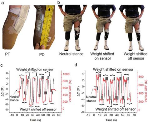 Textile Based Pressure Sensors For Monitoring Prosthetic Socket Interfaces Pmc
