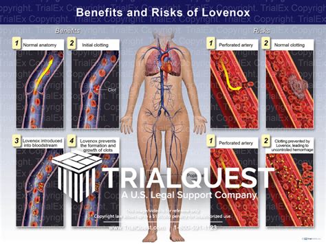 Benefits And Risks Of Lovenox Trialquest Inc