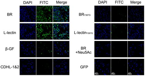 Contribution Of The L Lectin Module To Bacterial Adhesion To Human Lung Download Scientific
