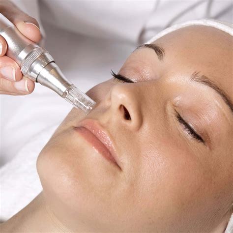 Microneedling Dermapen Mordi Beauty Clinic