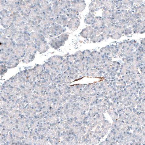 Mouse Monoclonal Anti Itgb3 Antibody Buy For Research Highly