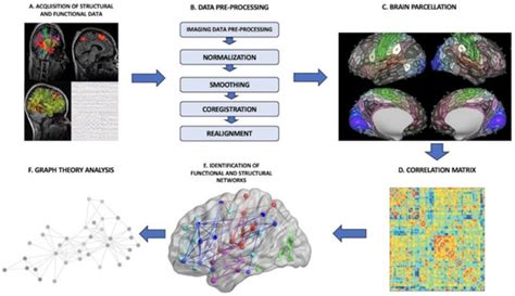 Life Free Full Text Connectome Based Neurosurgery In Primary Intra Axial Neoplasms Beyond