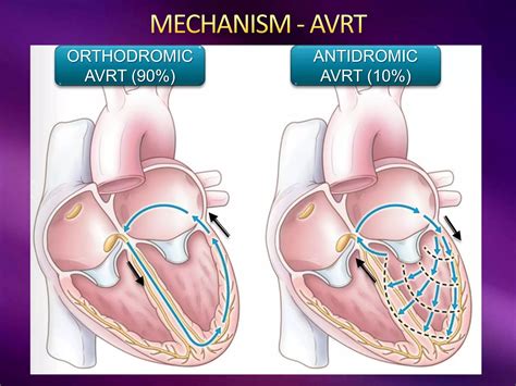 Atrial Tachy 26 Oct 22pptx