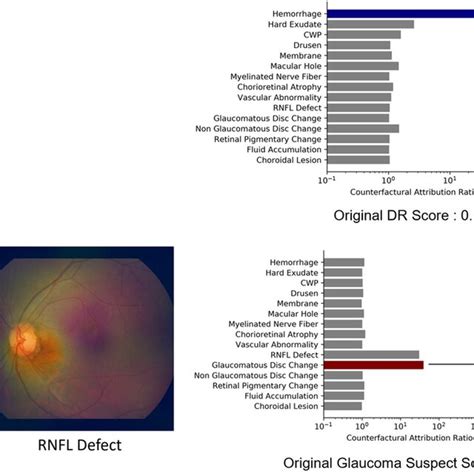 Interactive Diagnosis Using Counterfactual Attribution Ratio And The Download Scientific