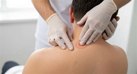 Sindrome Da Dolore Miofasciale Trigger Point E Trattamento Torrinomedica