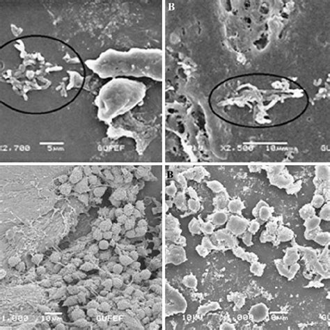 Scanning Electron Microscopy Of The Tympanic Membrane In Study A And