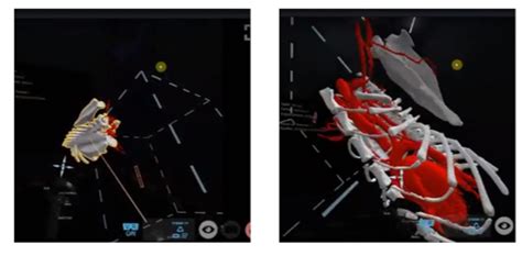 Phd Position For “integration Of Multimodal Imaging For Development Of