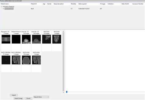 Failed To Execute Script App · Issue 130 · Invesaliusinvesalius3 · Github