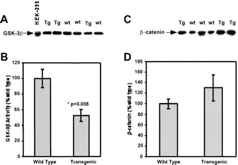 Transgenic Pkc βii Mice Exhibit Decreased Gsk 3β Activity And Increased Download Scientific