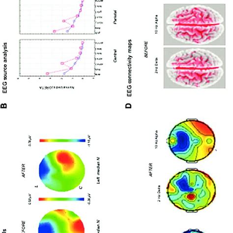 3 Assessment Of Cortical Organization And Reorganization Before And