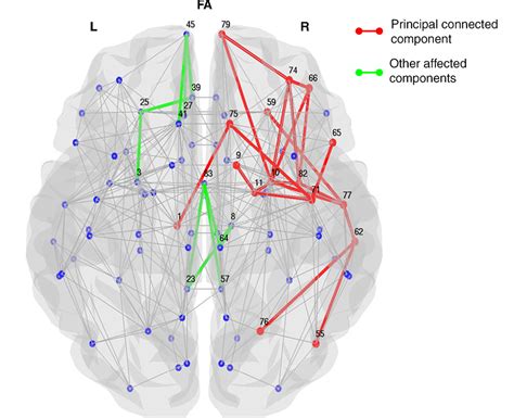 brain network connectivity