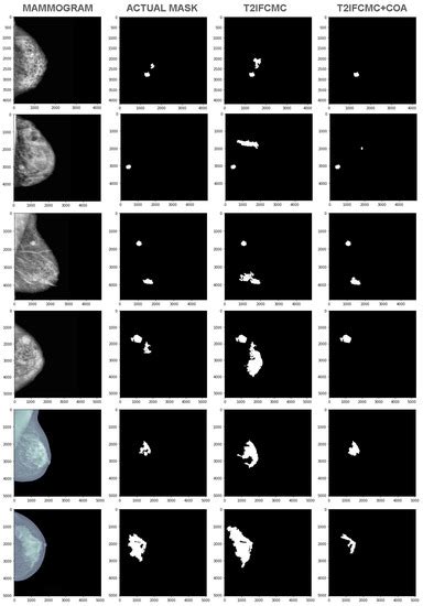 Chimp Optimization Algorithm Influenced Type 2 Intuitionistic Fuzzy C