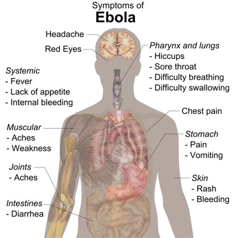 Ebola Virus Structure Genome Replication Pathogenesis Biology Notes Online