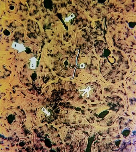 Bone Diagram Quizlet