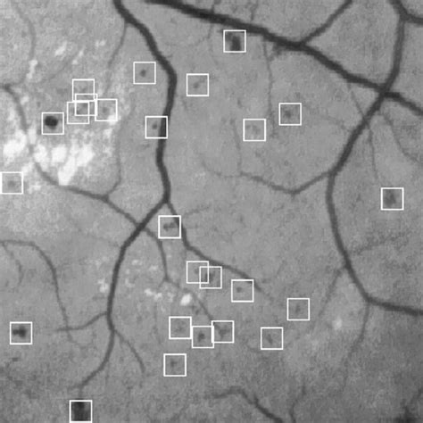Object Detection Problems Of Increasing Difficulty Download