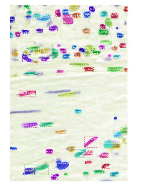 GitHub Siddhanthaldar Mask RCNN Nuclei Identification Using Instance Segmentation