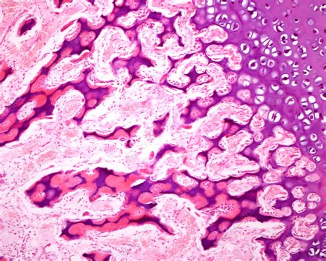 Developing Bone Light Micrograph Stock Image C057 6800 Science Photo Library