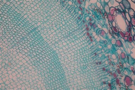 Cross Section Dicot Monocot And Root Of Plant Stem Under The