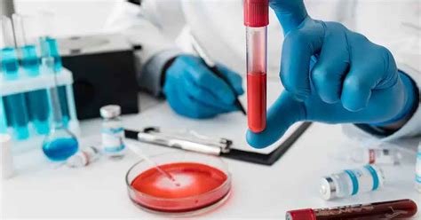 Understanding Hiv Testing Types And Procedures