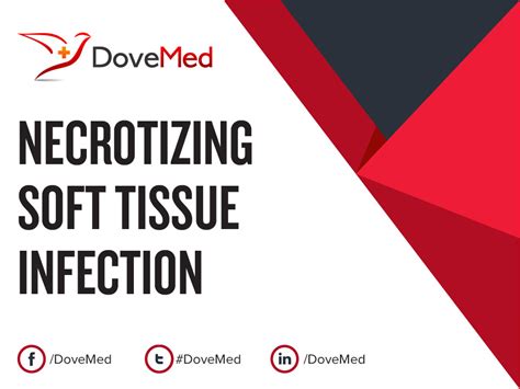 Necrotizing Soft Tissue Infection