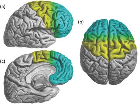 Lateral Brain